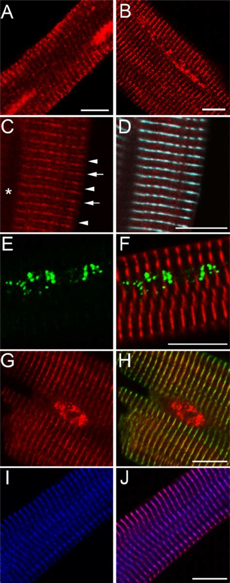 Differential Subcellular Localization Of PP A Regulatory Subunits In Download Scientific