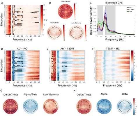 Figure 1 From Eeg Spectral Power Abnormalities And Their Relationship