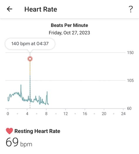 Heart Rate Tracker Anomalies Atrial Fibrillati