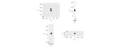 R How To Keep Consistent Axes Scaling In A Grid Of Ggplot2 Plots With
