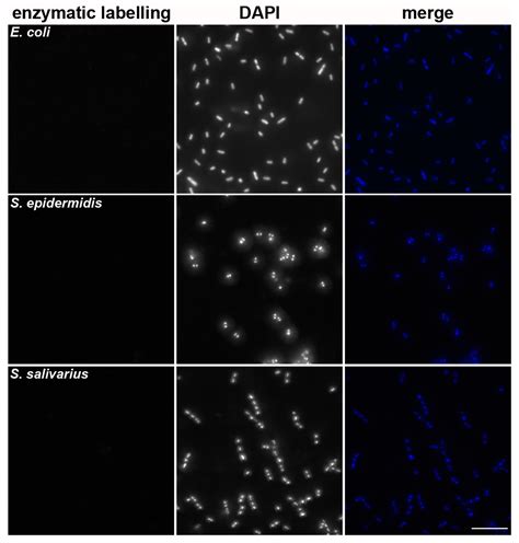 A New Sensitive Method For The Detection Of Mycoplasmas Using