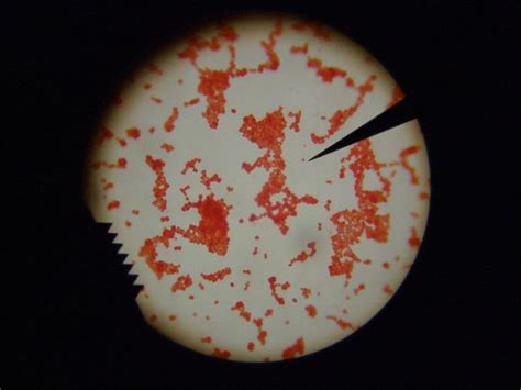 MedicALI Microbiology Simple Staining Inspection