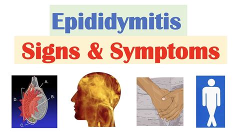 Epididymitis Scrotal Pain Signs And Symptoms And Why They Occur Youtube