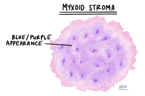 What Is Myxoid Stroma A Deep Dive Into Tissue Support Food Stamps