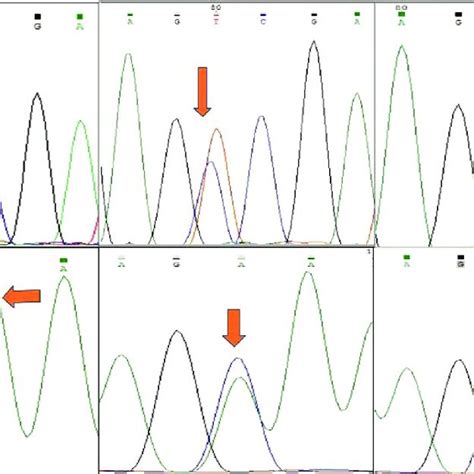 Representative Sequencing Chromatogram Profiles Of Controlscases Download Scientific Diagram