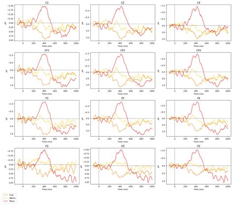 Regression Modelling Erps And More