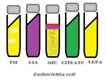Diagnostico Pruebas Bioquimicas Bioquímica Microbiología