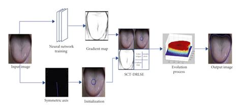 flowchart of symmetry and edge constrained level set model for tongue