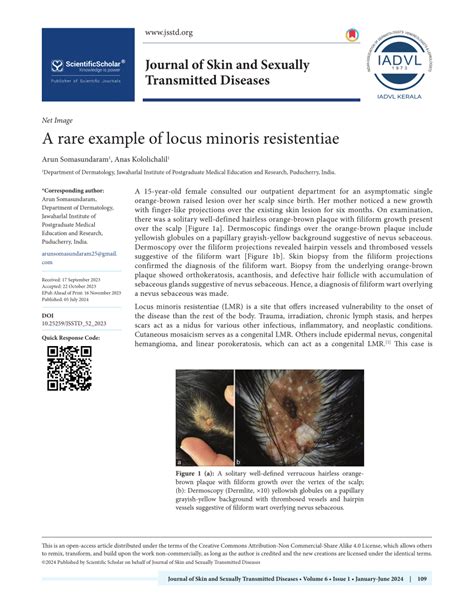 Pdf A Rare Example Of Locus Minoris Resistentiae