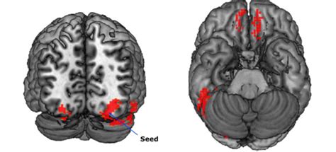 Spatial Coding And Similar Spatial Patterns In The Brain Part 2 General Neuroscience