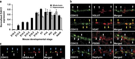 Temporal Expression Pattern And Subcellular Localization Of Cdh13 A