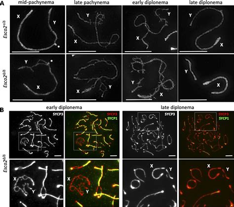 Meiotic Sex Chromosome Cohesion And Autosomal Synapsis Are Supported By Esco2 Life Science