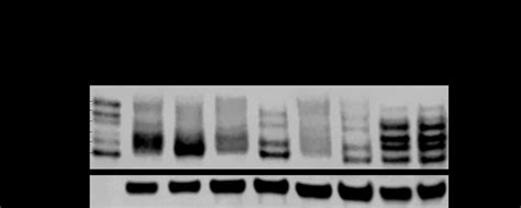 Tau Immunoblot Of 300 Div 2d Forebrain And Encor Lysates Tau Isoform