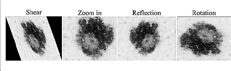Figure 1 From Design Of An Efficient Deep Learning Model For Segmentation And Classification Of