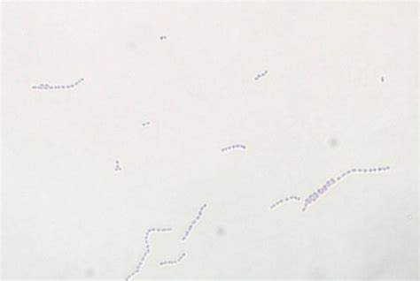 Streptococci Flashcards Quizlet