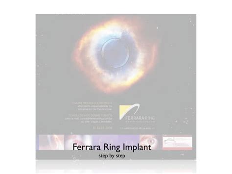 Icrs Ferrara Ring Key