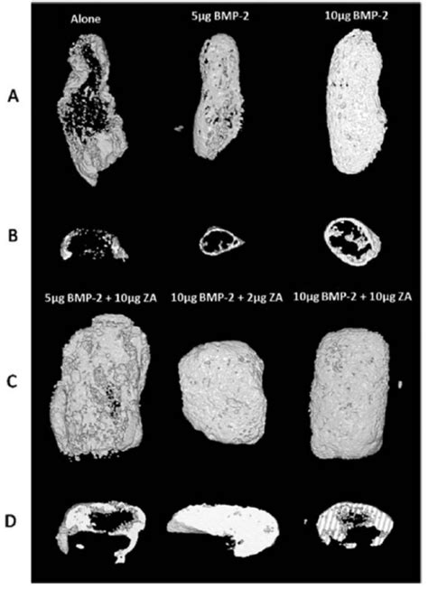 Anabolic And Antiresorptive Actions Of Locally Delivered