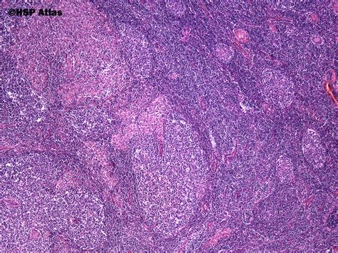 Hsp Atlas Histopathology Atlas