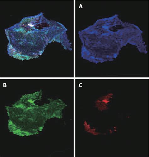 Figure 1 From Concept Of The Pathogenesis And Treatment Of Cholelithiasis Semantic Scholar