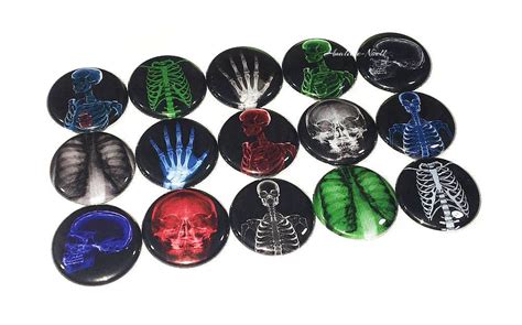 Radiology Xray 1 125 Button Xray Button Etsy