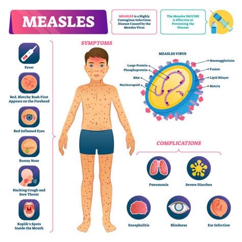 Measles Illustration Illustrations Royalty Free Vector Graphics And Clip