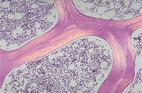 Spongy Bone Histology