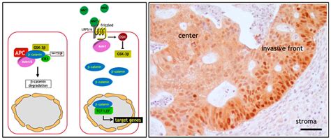 The A Wntβ Catenin Signal Transduction Pathway And The B β Catenin