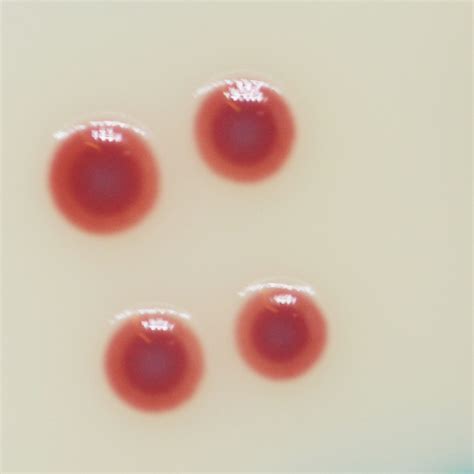 Chromagar™ Acinetobacter Chromagar