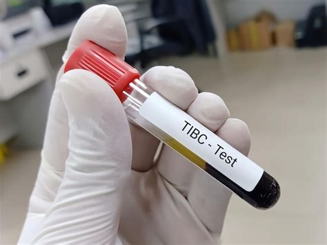 Premium Photo Biochemist Or Lab Technologist Holds Blood Sample For
