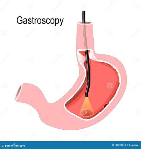 Panendoscopy Cartoons Illustrations And Vector Stock Images 9 Pictures