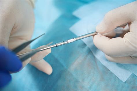 Tips For Post Pellet Insertion Trocar Supplies