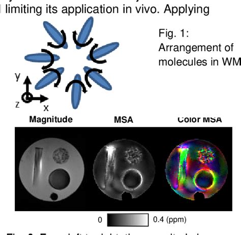 Figure 1 From Time Resolved Whole Brain Cmro 2 Quantification By Mr Susceptometry And Flow