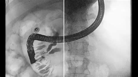 Dynamic Unique Fluoroscopy Software Philips Healthcare
