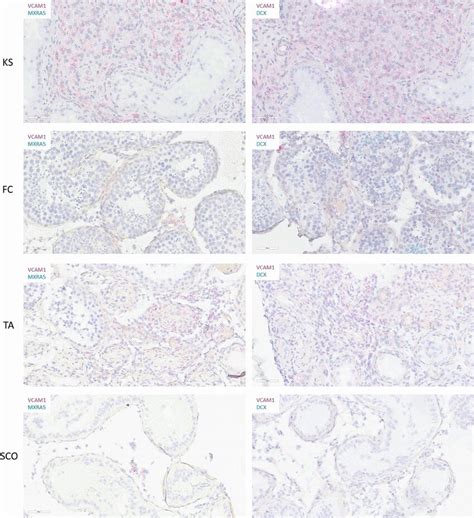 Validation Of The Gene Expression Results By Rna In Situ Hybridization Download Scientific