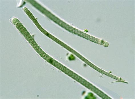 Prokaryote Calothrix