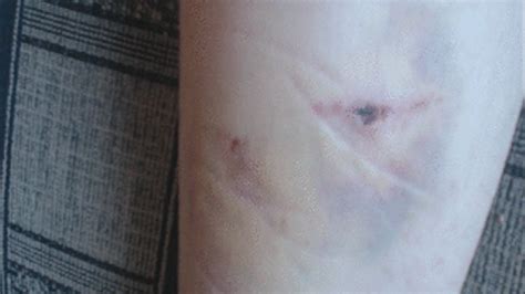 My New Ugly Bruise Mp4 Hotkati1 Clips4sale