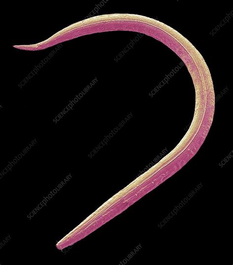 Freshwater Nematode Sem Stock Image C037 8051 Science Photo Library