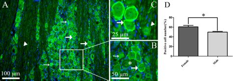 Progesterone Distribution In The Trigeminal System And Its Role To