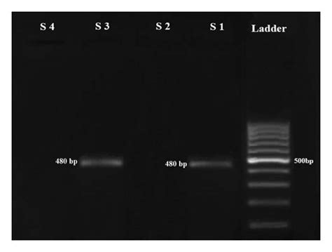 Identiication Of Cryptosporidium Parvum Using Nested Pcr Gel Download Scientific Diagram