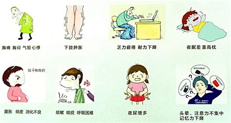 心衰症状 心衰心电图 心衰 大山谷图库