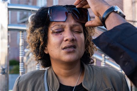 Nyc Subway Beating Vic Reveals Injuries And Issues Plea To Adams