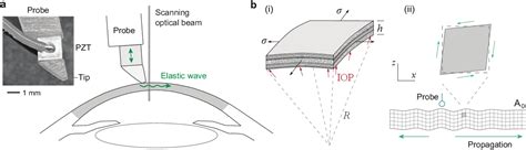 Figure 4 From In Vivo Optical Coherence Elastography Unveils Spatial Variation Of Human Corneal