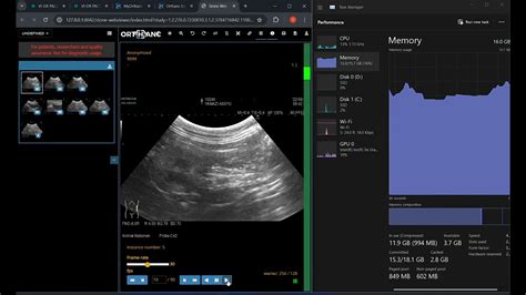 Loading Time Of The Ultrasound Sequence File General Orthanc Users