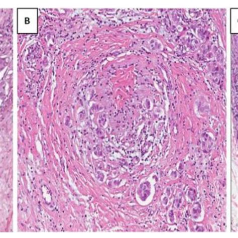 Hematoxylin And Eosin Hande Stained Sections Illustrating Breast Download Scientific Diagram