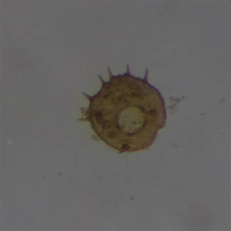 Centropyxis From Sargeant Bay Provincial Park Redrooffs Road Halfmoon