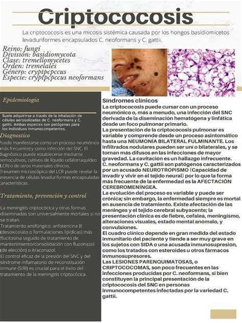 Criptococosis Pdf