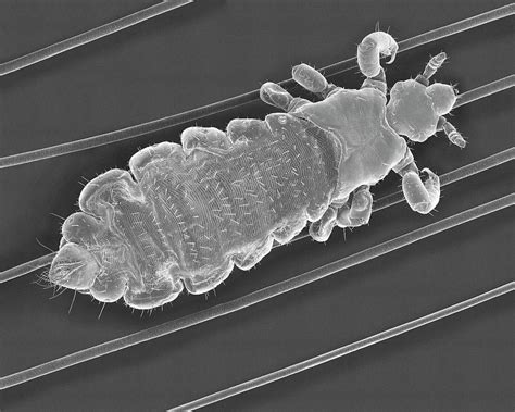 Lice Under Microscope