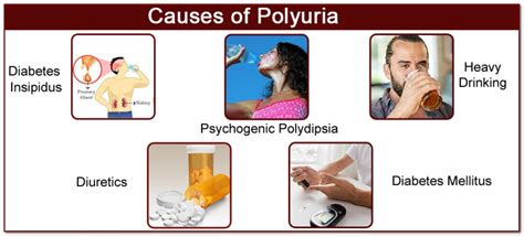 3 Ps Of Diabetes Polyuria Polyphagia Polydipsia Explanation