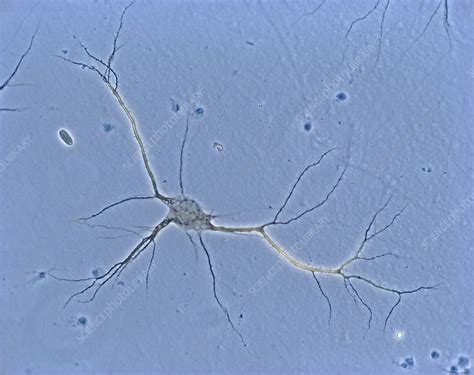 Nerve Cell Light Micrograph Stock Image C0199648 Science Photo