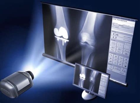 ارتقای کیفیت تصویربرداری پزشکی با مدل‌سازی ریاضی ایرنا